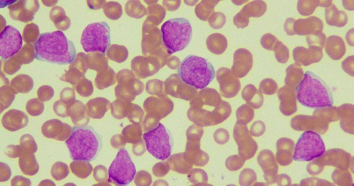 Medical Imaging and Pediatric and Adolescent Hematologic Cancer Risk ...